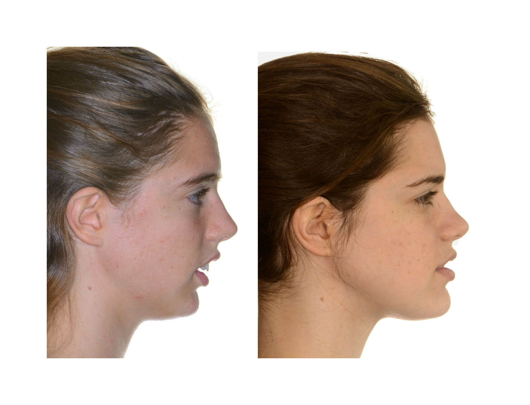 Anna - Instituto Maxilofacial