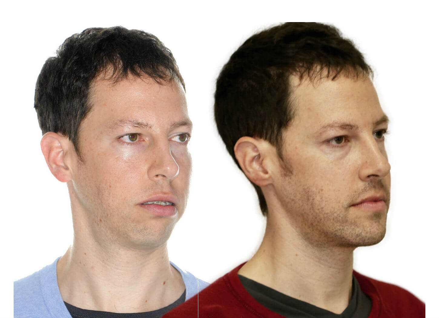 Daniel - Instituto Maxilofacial