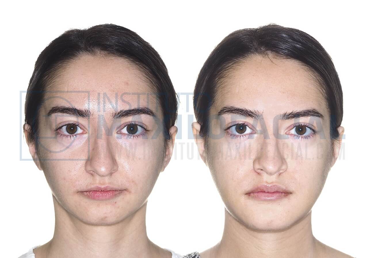 Elena Instituto Maxilofacial