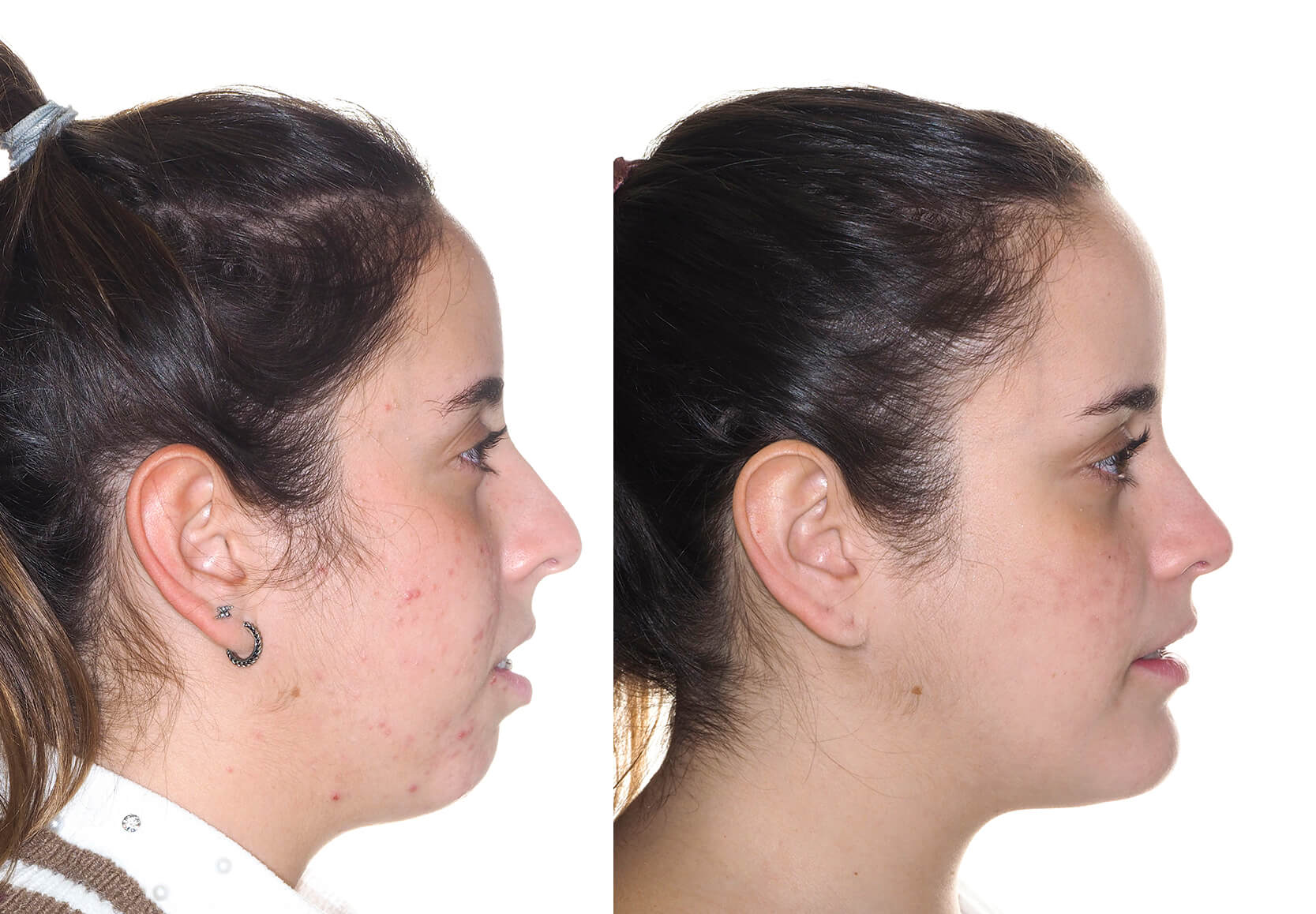 Cristina - Instituto Maxilofacial