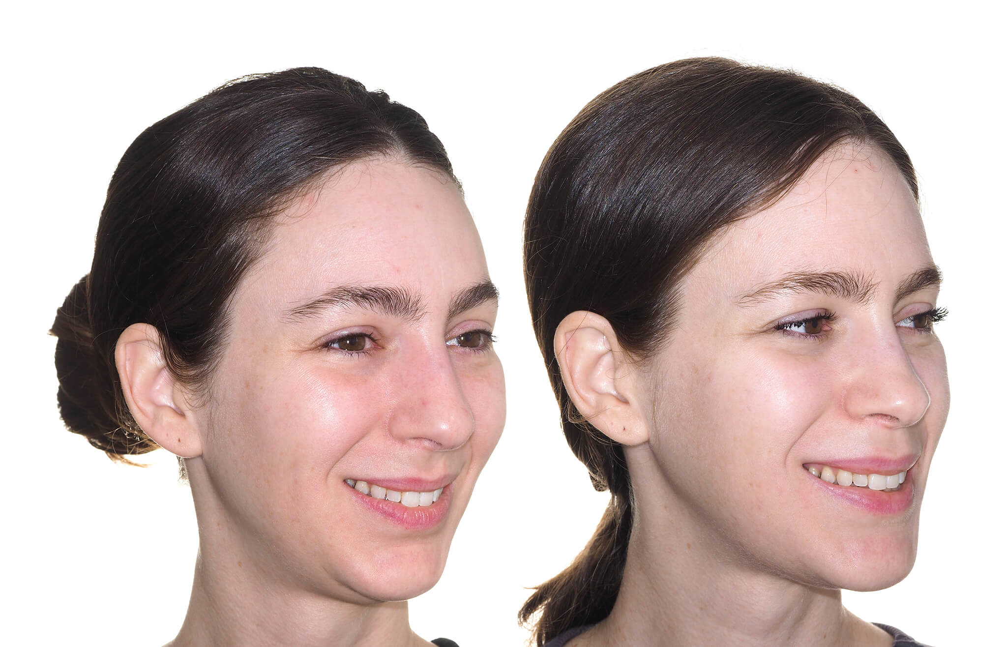 Leanne - Instituto Maxilofacial