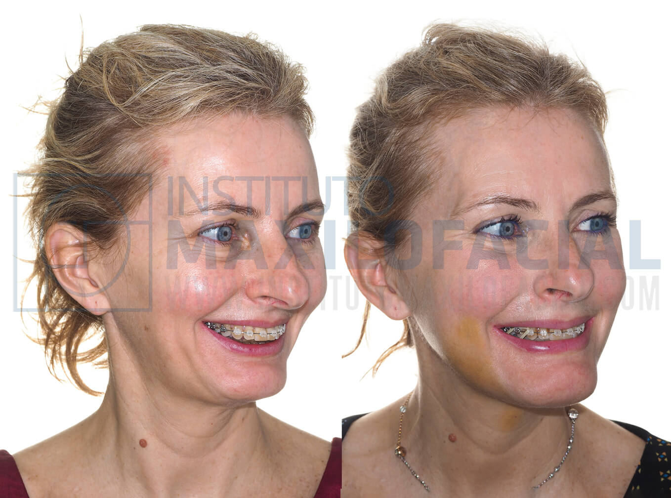 Rosina - Instituto Maxilofacial