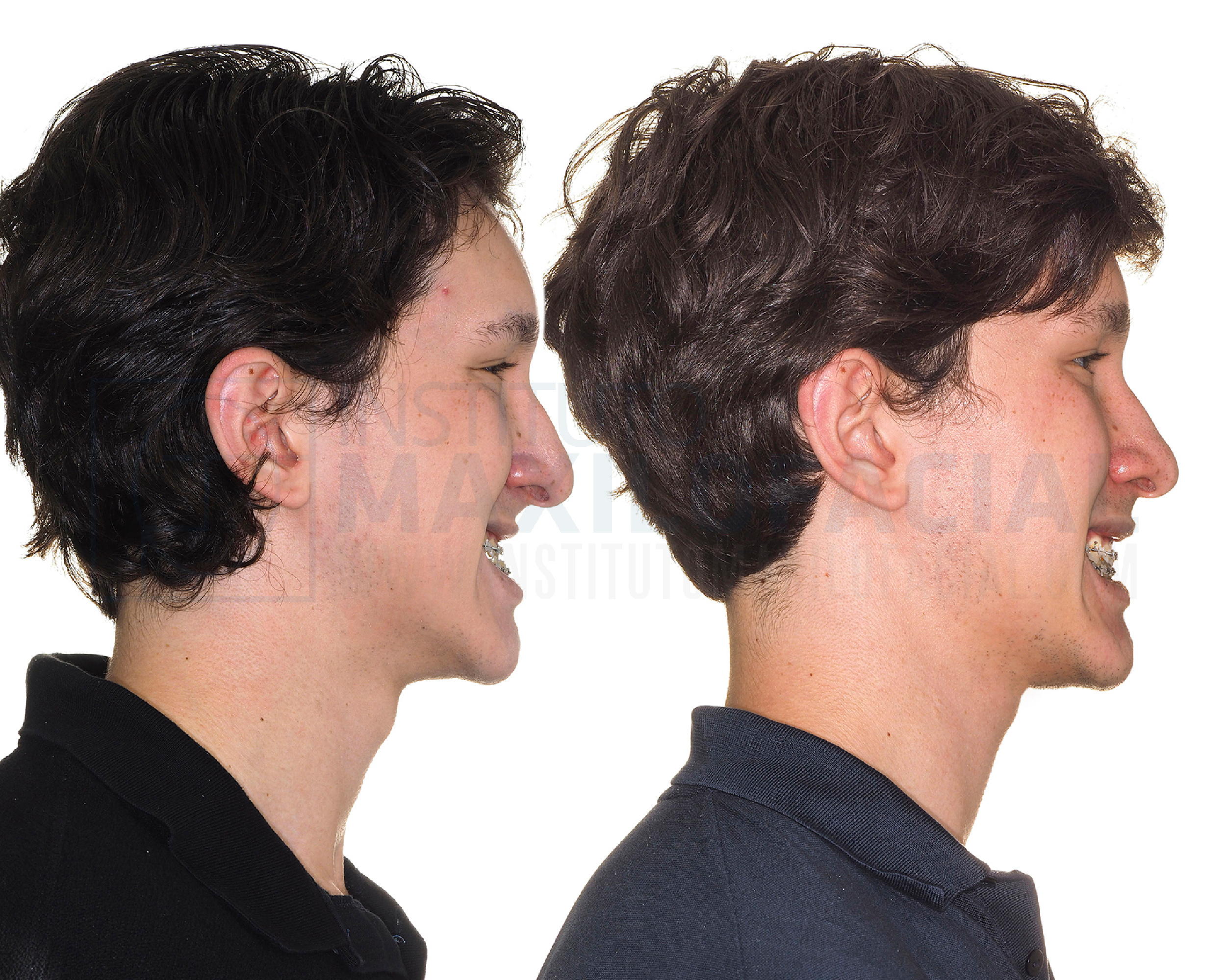 Ian - Instituto Maxilofacial