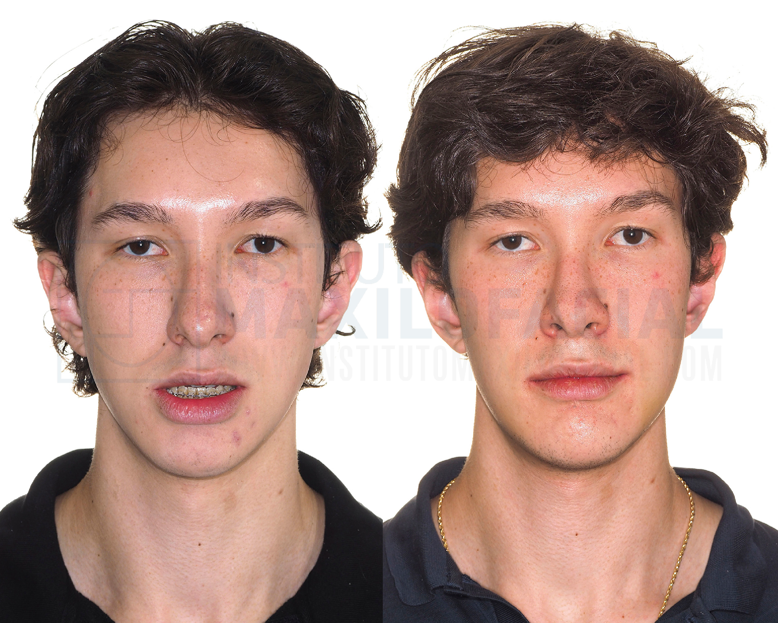 Ian - Instituto Maxilofacial