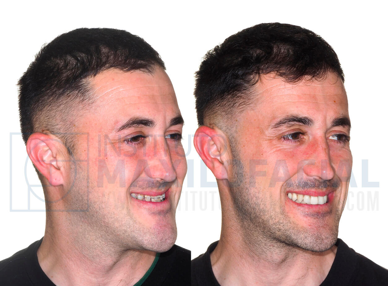 Daniel - Instituto Maxilofacial